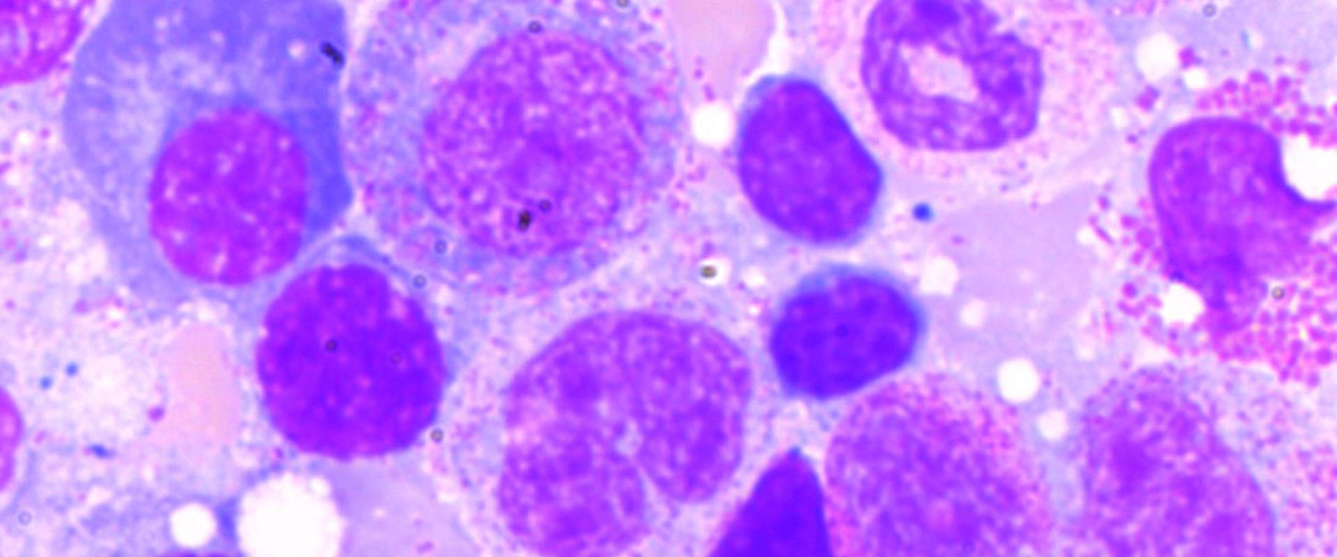 Spezielle Diagnostik Hämatologie & Onkologie | amedes Halle/Leipzig