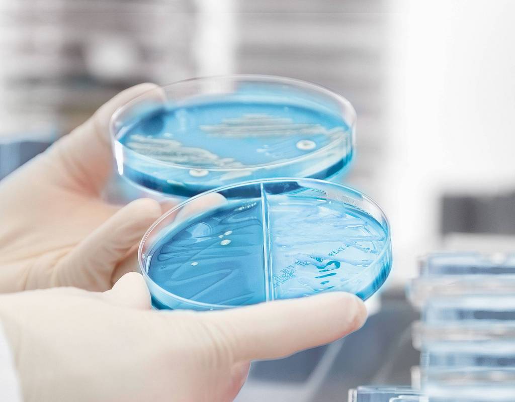 Mikrobiologie | amedes Halle/Leipzig